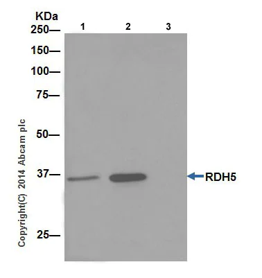 Anti-RDH5 antibody [EPR15191] - BSA and Azide free (ab251299) | Abcam