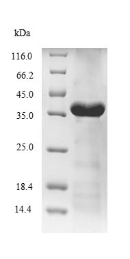 Recombinant DNA ligase protein (His tag) (ab238367) | Abcam