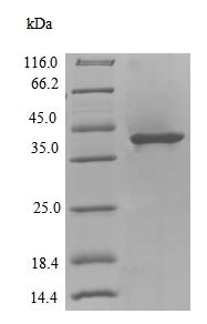 Recombinant DNA polymerase IV protein (ab238357) | Abcam