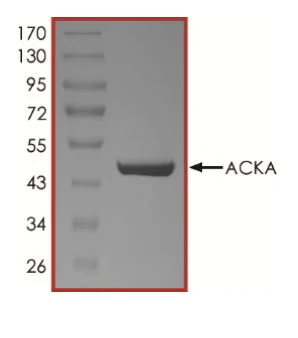Recombinant E. coli Acetate Kinase protein (His tag) (ab268313) | Abcam