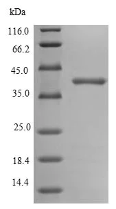 Recombinant E. coli Outer membrane protein C (His tag) (ab236921) | Abcam