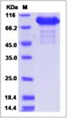 Recombinant Human ABP1 protein (His tag) (ab276566) | Abcam