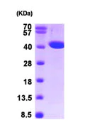 Recombinant Human ACADS/SCAD protein (ab95383) | Abcam
