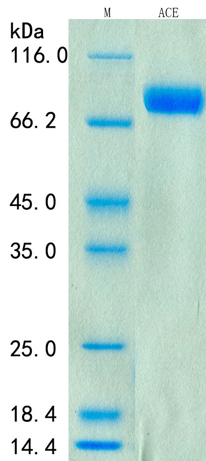Recombinant Human ACE Protein Standard (His tag) (ab316476) | Abcam