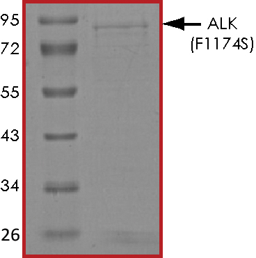 Recombinant human ALK (mutated F1174S) protein (Active) (ab268318) | Abcam