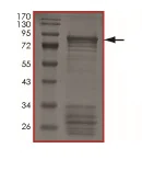 Recombinant human ALK (mutated G1202R) protein (Active) (ab186458) | Abcam