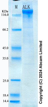 Recombinant Human ALK Protein Standard (His tag) (ab316706) | Abcam