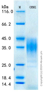 Recombinant Human alpha 1 Acid Glycoprotein Protein Standard (His tag ...