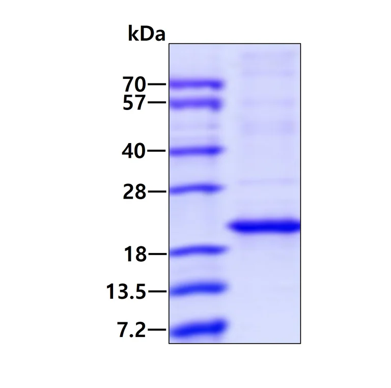 Recombinant human alpha A Crystallin/CRYAA protein (ab48778) | Abcam