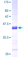 Recombinant Human APRIL/TNFSF13 protein (ab160170) | Abcam