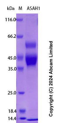 Recombinant Human ASAH1 Protein Standard (His tag) (ab323118) | Abcam