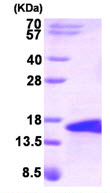 Recombinant Human BMP5 protein (ab87627) | Abcam