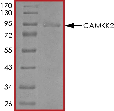 Recombinant human CAMKK2 protein (Active) (ab268380) | Abcam