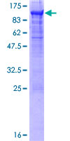 Recombinant Human Carcino Embryonic Antigen CEA protein (ab158095) | Abcam