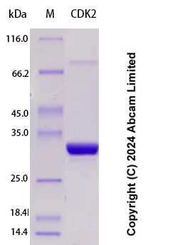 Recombinant Human CDK2 Protein Standard (ab323085) | Abcam