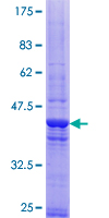 Recombinant Human CEP290 protein (ab164215) | Abcam