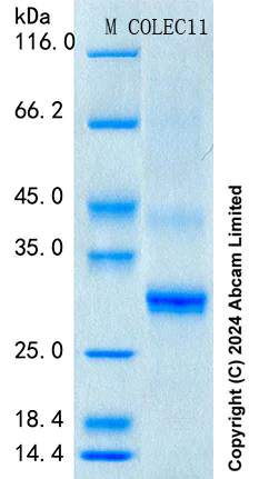 Recombinant Human COLEC11 Protein Standard (ab316667) | Abcam