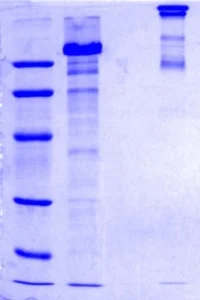 Recombinant Human COMP/Cartilage oligomeric matrix protein (ab104358 ...