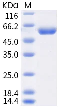 Recombinant Human coronavirus SARS-CoV-2 Spike RBD (mutated K417T ...