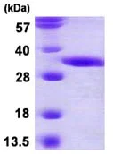Recombinant Human DECR2/PDCR protein (ab116178) | Abcam