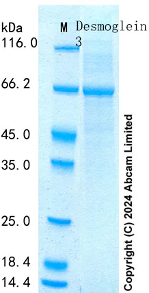 Recombinant Human Desmoglein 3 Protein Standard (His tag) (ab316542 ...