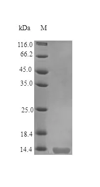 Recombinant human DR5 protein (Active) (ab243777) | Abcam