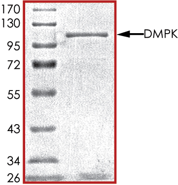 Recombinant human Dystrophia myotonica protein kinase / DMPK (ab85755 ...