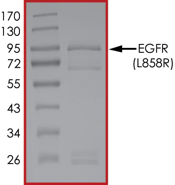 Recombinant human EGFR (mutated L858R) protein (Active) (ab268502) | Abcam