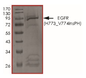 Recombinant human EGFR protein (H773_V774insPH) (Tagged) (ab268487) | Abcam