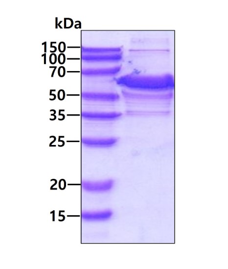 Recombinant Human ETS2 protein - BSA and Azide free (denatured ...