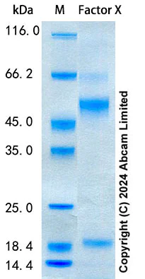 Recombinant Human Factor X Protein Standard (His tag) (ab316690) | Abcam