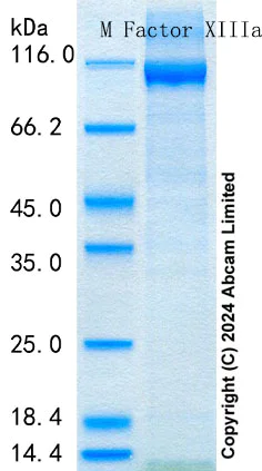 Recombinant Human Factor XIIIa Protein Standard (His tag) (ab316718 ...