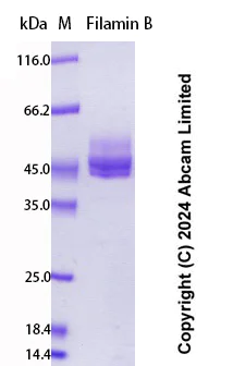 Recombinant Human Filamin B Protein Standard (ab323119) | Abcam