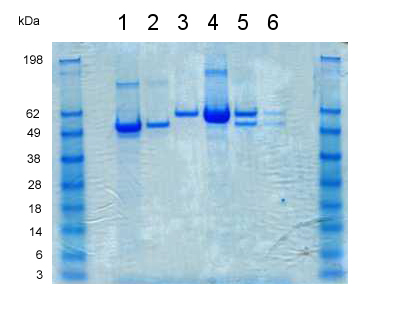 Recombinant human GAD65 protein (ab206646) | Abcam