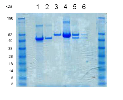 Recombinant human GAD65 protein (ab206646) | Abcam