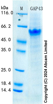 Recombinant Human GAP43 Protein Standard (His tag) (ab316663) | Abcam