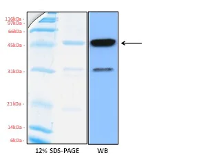 Recombinant Human Gelsolin protein (His tag) (ab233671) | Abcam