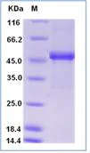 Recombinant Human GPx-7 protein (Fc Chimera) (ab276487) | Abcam