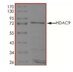Recombinant human HDAC9 protein (Active) (ab268620) | Abcam