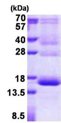 Recombinant Human Hemoglobin subunit gamma-1 protein (ab156712) | Abcam
