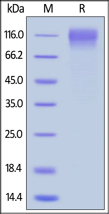 Recombinant Human HIV-1 gp120 (CN54) protein (ab174070) | Abcam