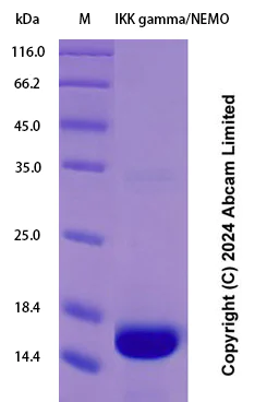 Recombinant Human IKK gamma/NEMO Protein Standard (His tag) (ab323149 ...