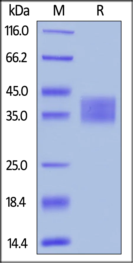 Recombinant human IL-2 Receptor alpha protein (Active) (ab221397) | Abcam