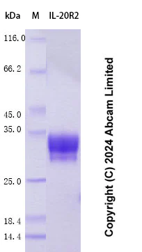 Recombinant Human IL-20R2 Protein Standard (His tag) (ab323049) | Abcam