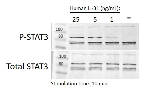 重组人IL-31蛋白(活性) (ab242434)| Abcam中文官网