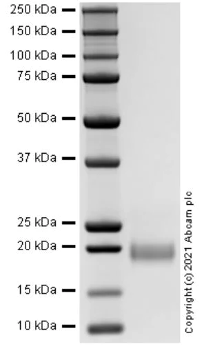 Recombinant Human IL-31 protein (Active) (ab283936) | Abcam