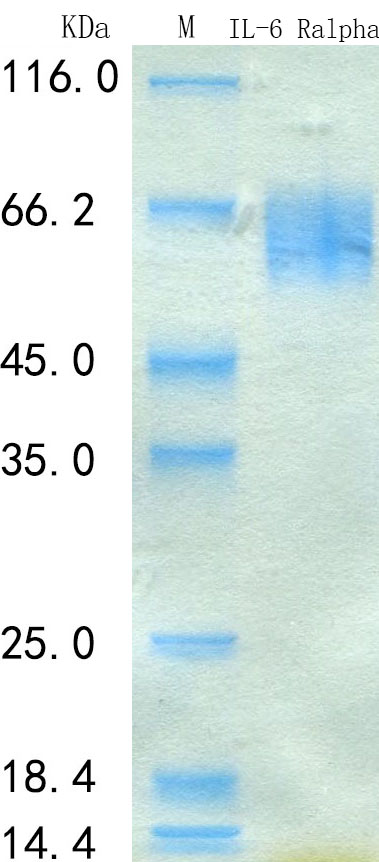 Recombinant Human IL-6 R alpha Protein Standard (His tag) (ab316569) | Abcam
