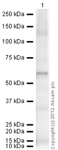 Recombinant Human Integrin linked ILK protein (ab83119) | Abcam