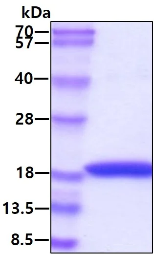 Recombinant human Interferon alpha 1 protein (Active) (ab48750) | Abcam