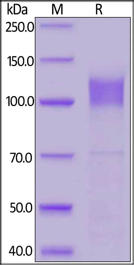 Recombinant Human Interferon alpha/beta receptor 1 protein (Fc Chimera ...